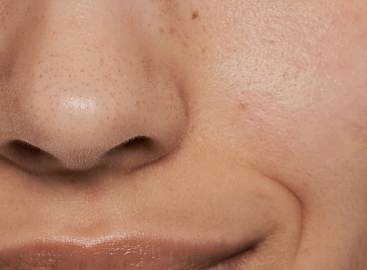 How To How To Get Rid Of Blackheads Skin School Clinique