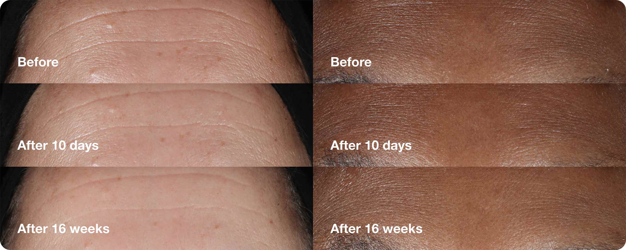 Clinique Smart Clinical Repair™ Wrinkle Correcting Serum | Clinique